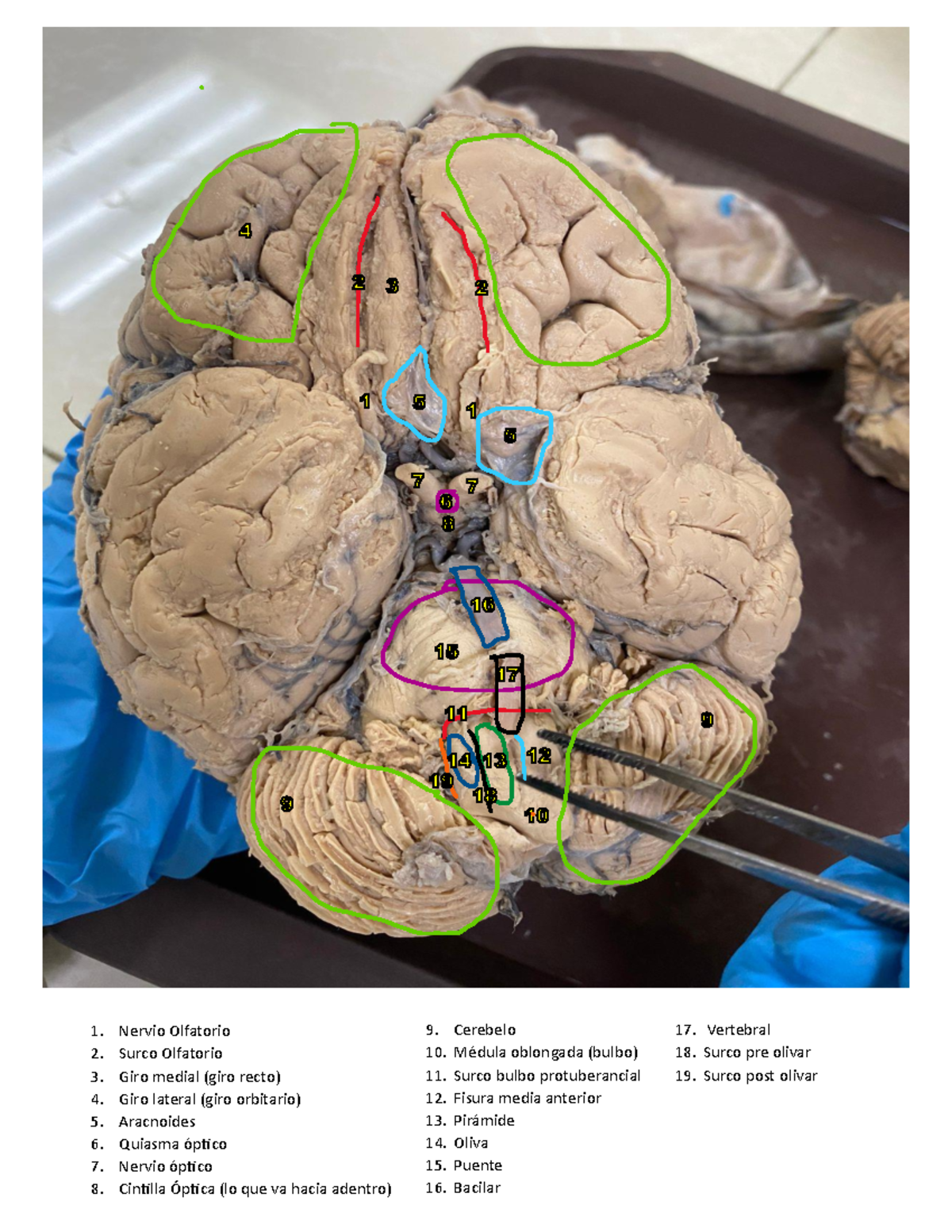 Neuroanatomía parte 1 - Nervio Olfatorio Surco Olfatorio Giro medial ...