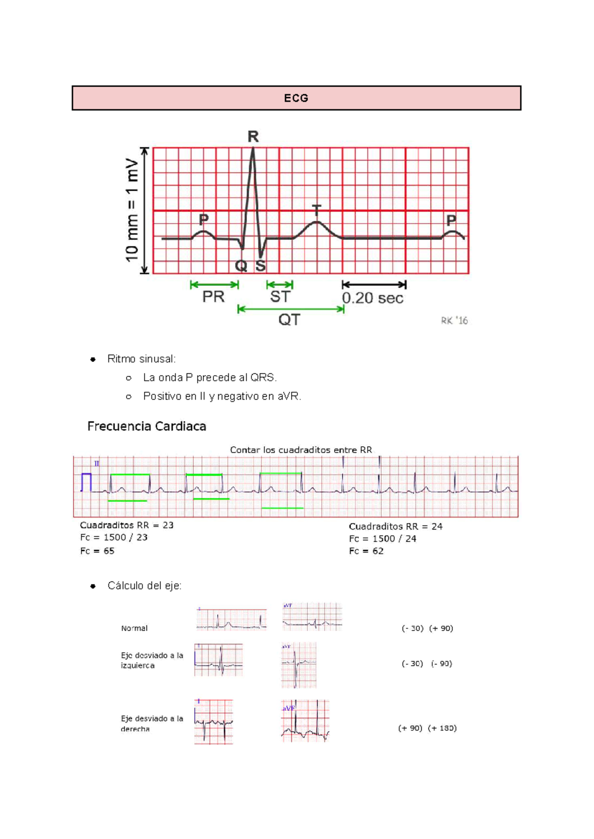 ECG - Repaso de Ritmos y Diagnósticos Clave para el Curso - Studocu