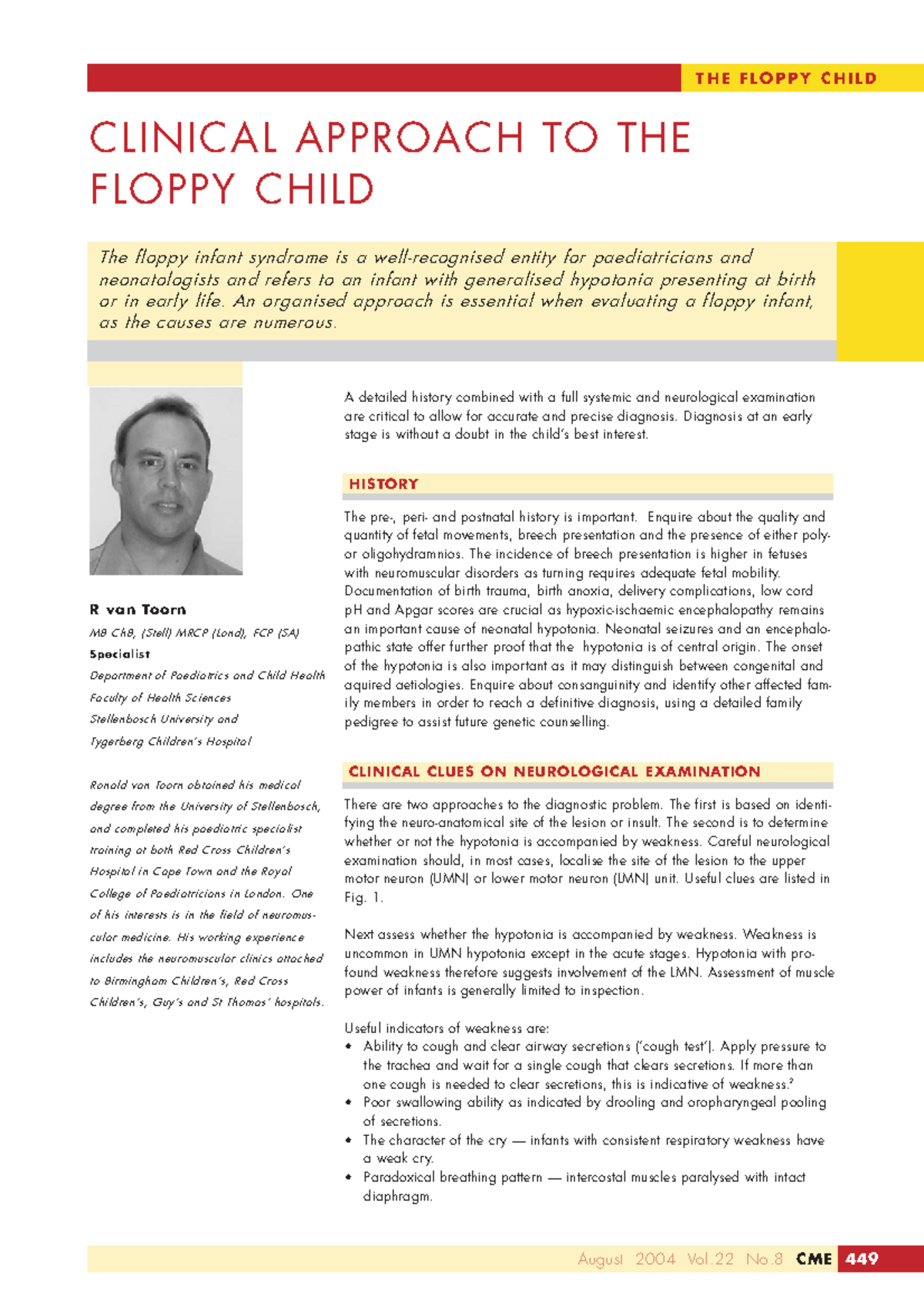 CME 449: Clinical Approach to the Floppy Child - Studocu