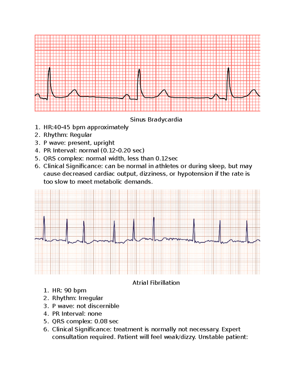 Cardiac Rhythms Strips Analysis: Sinus Bradycardia & Atrial ...