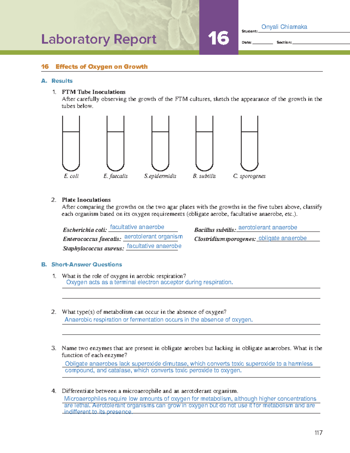 Exercise 16 Lab Report - Laboratory Report Student: Date: Section: 117 ...