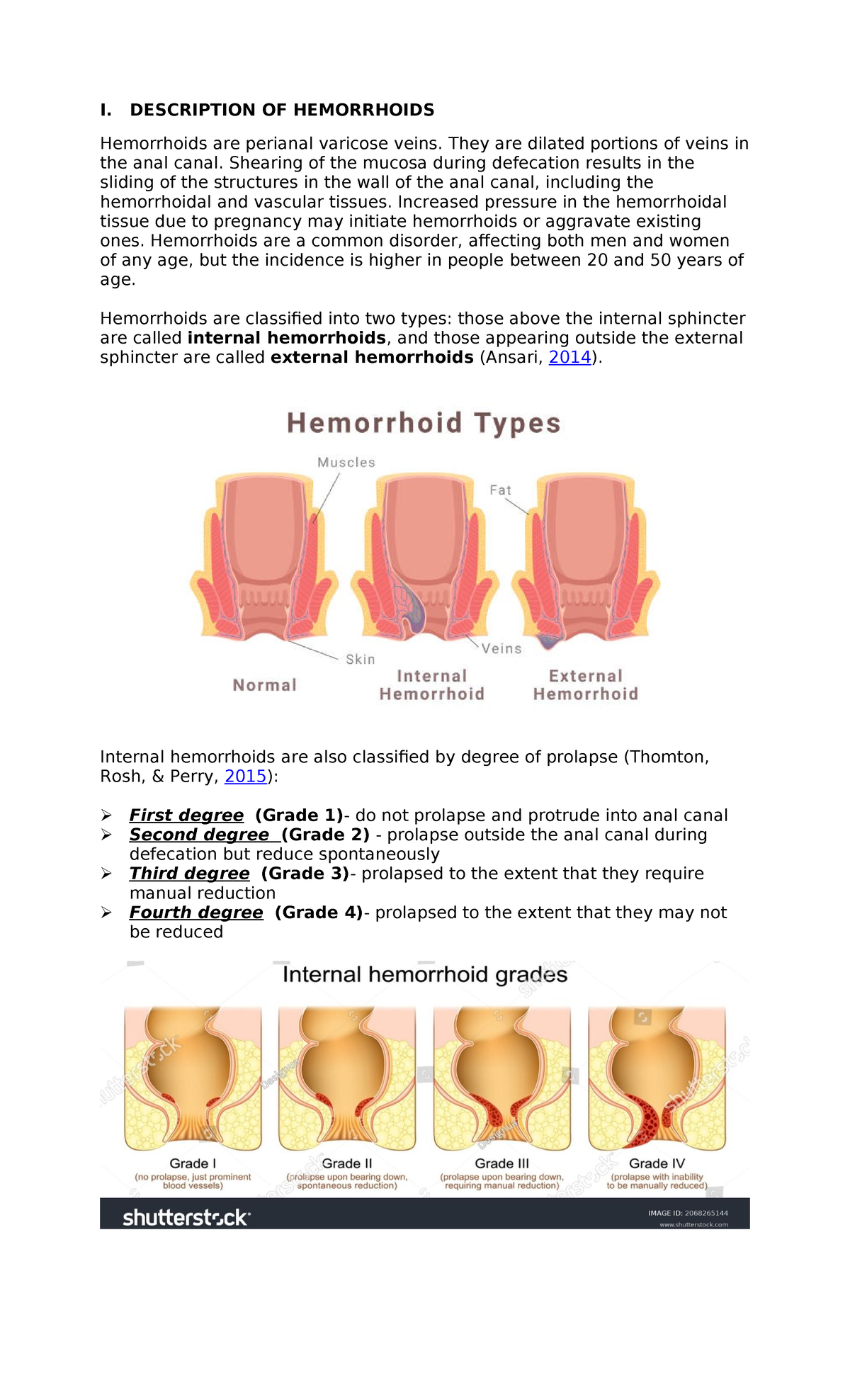 Nursing Management and Pathophysiology of Hemorrhoids (NUR 101) - Studocu