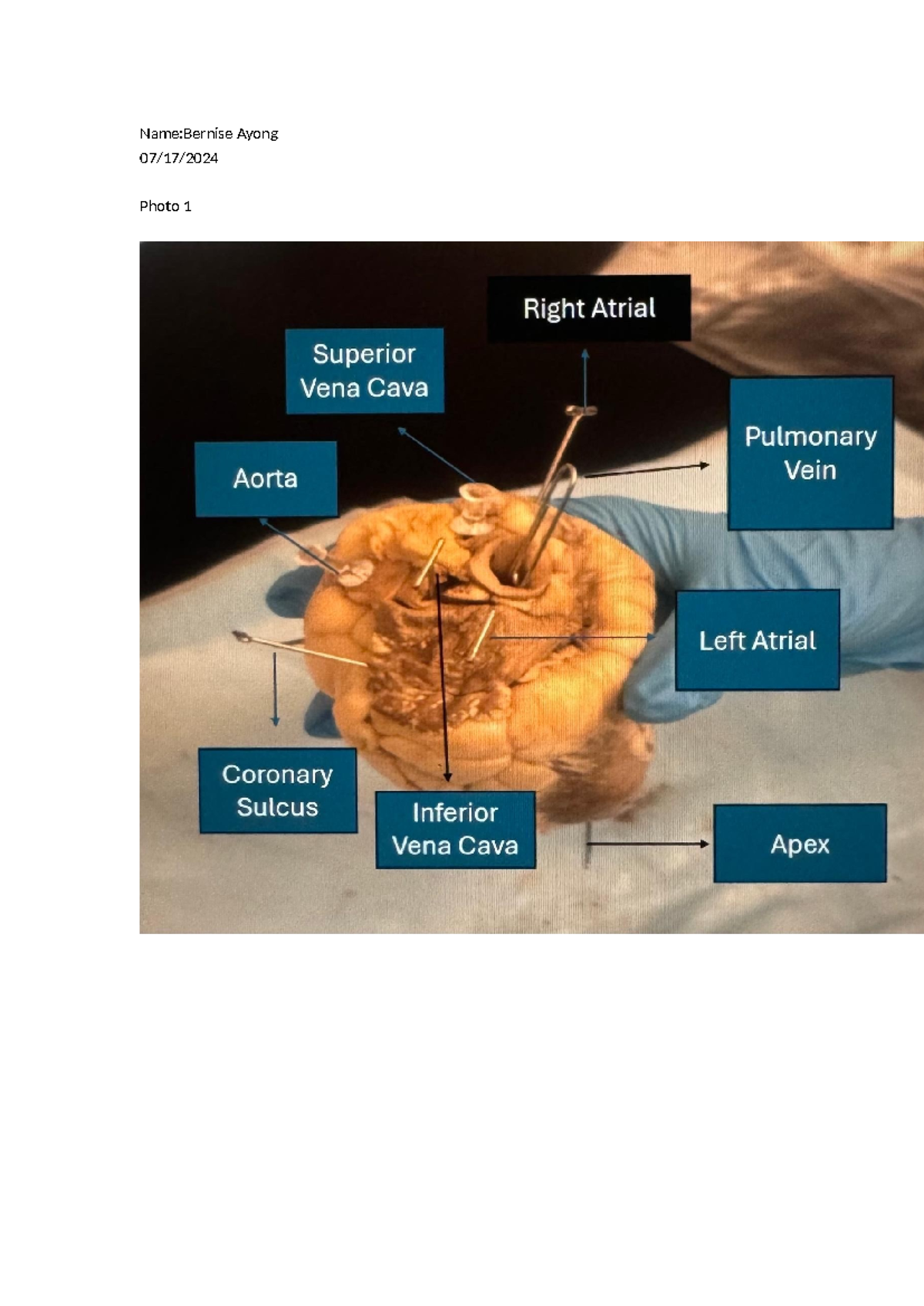 Heart dissection - Practicals - BIOLOGY 226 - Name: Bernise Ayong Photo ...
