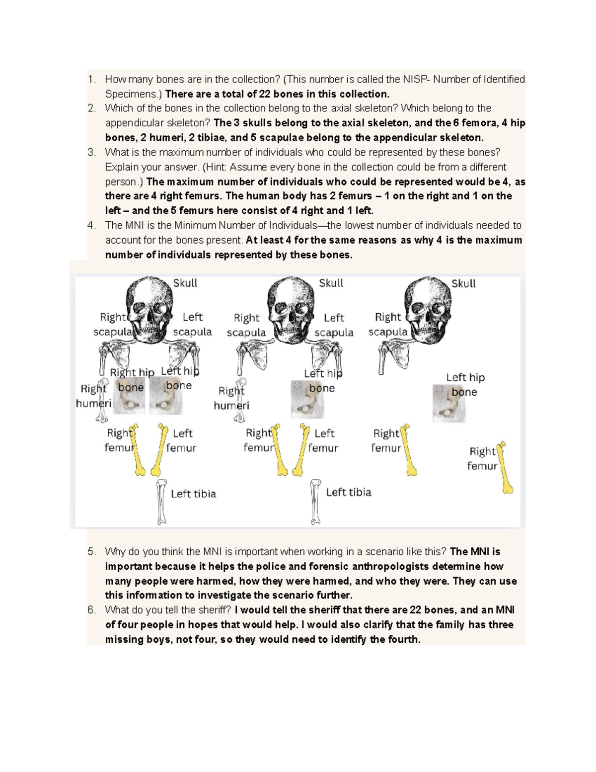 Human Skeleton Assignment: Analyzing Bone Collection (BIO101) - Studocu