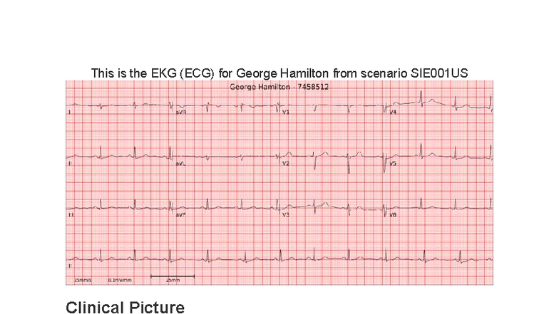 Normal EKG Analysis for George Hamilton - SIE001US - Studocu