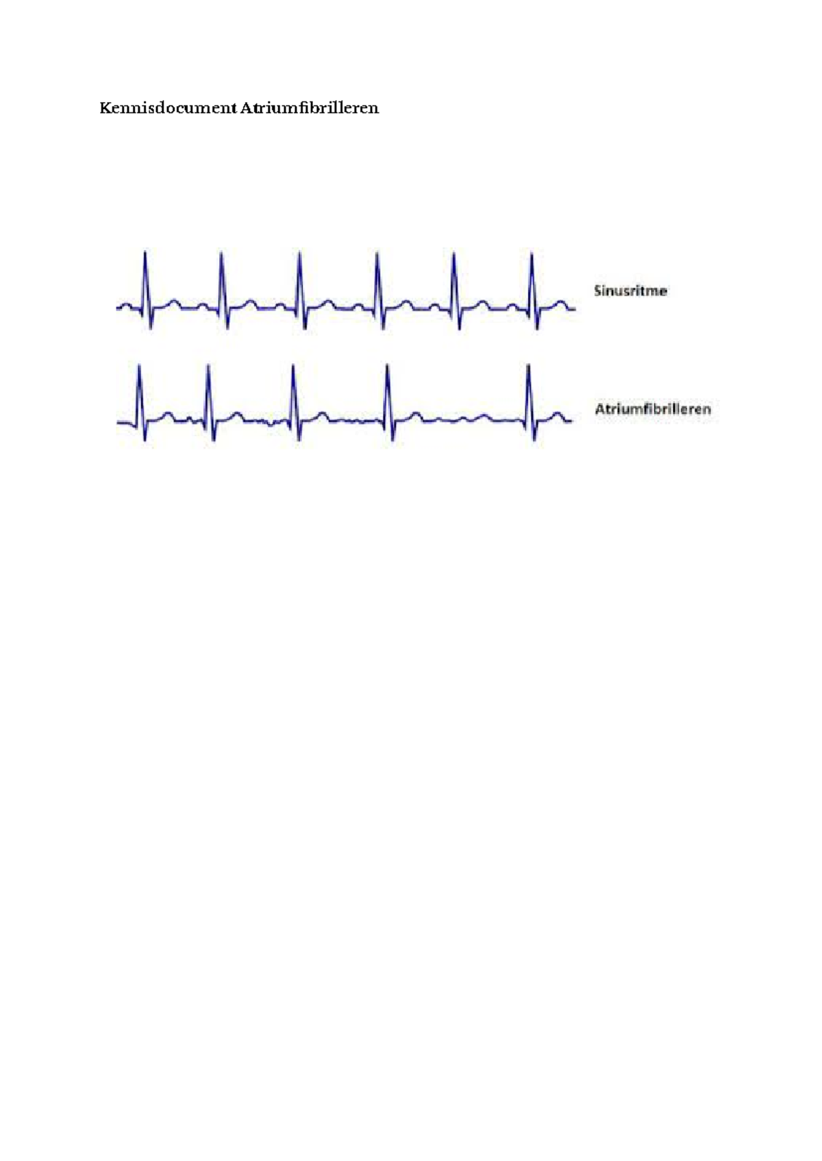 Kennisdocument over Atriumfibrilleren en Risicofactoren - Studeersnel