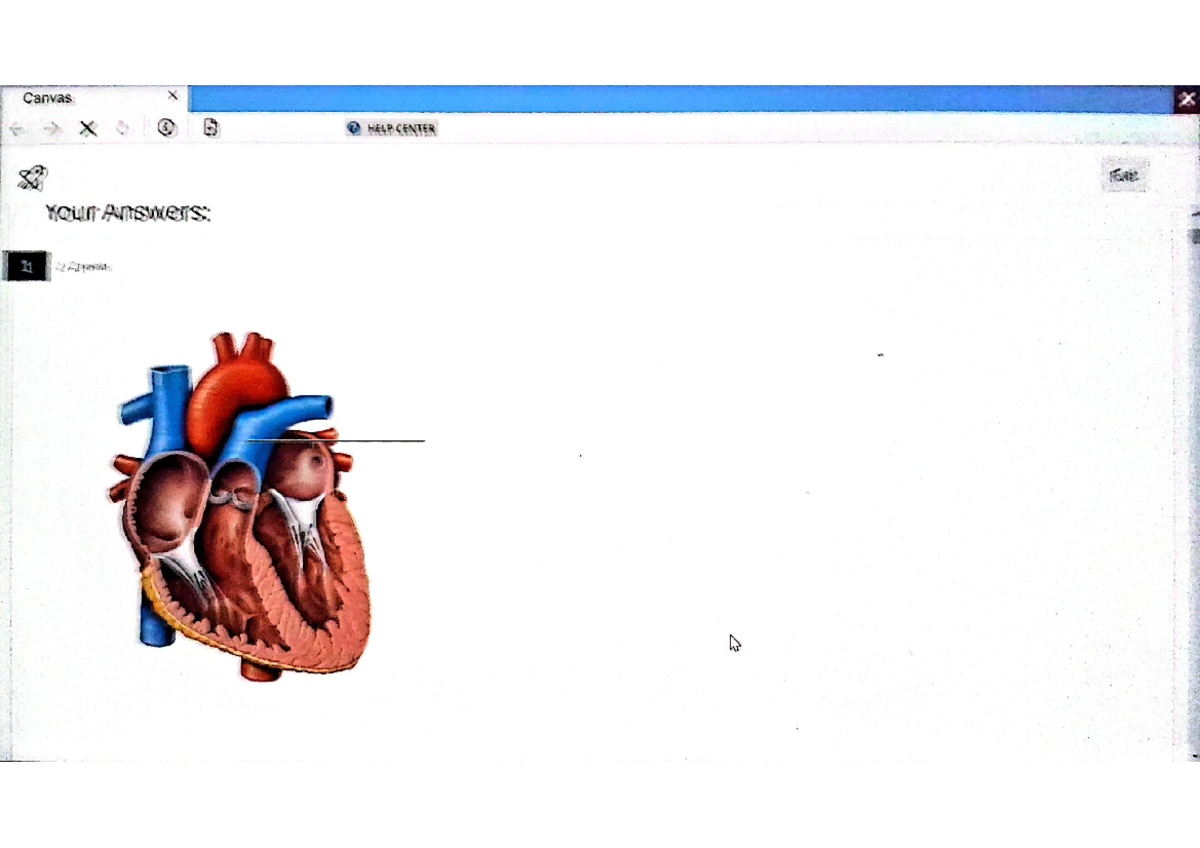 A&P Module 2 Practice Exam: Heart Anatomy & Function Review - Studocu