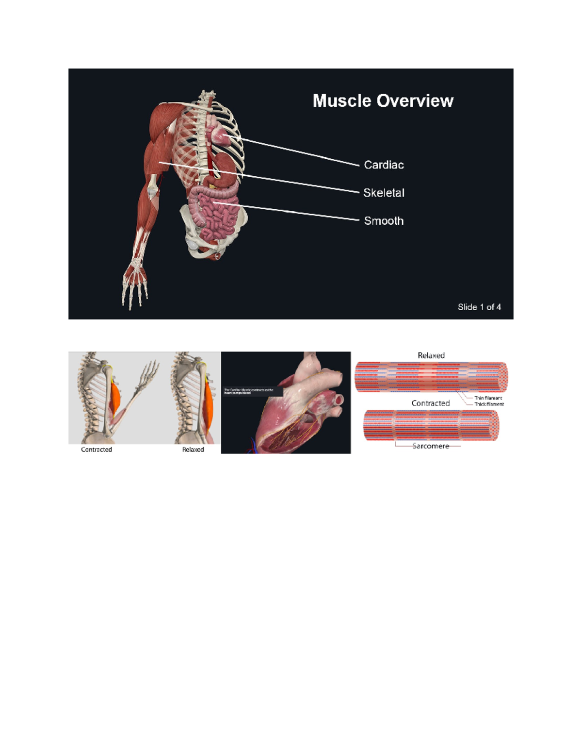 LAB PRACTICUM pic - Muscle Overview Cardiac Skeletal Smooth Slide 1 of 4 Relaxed Thin filament ...