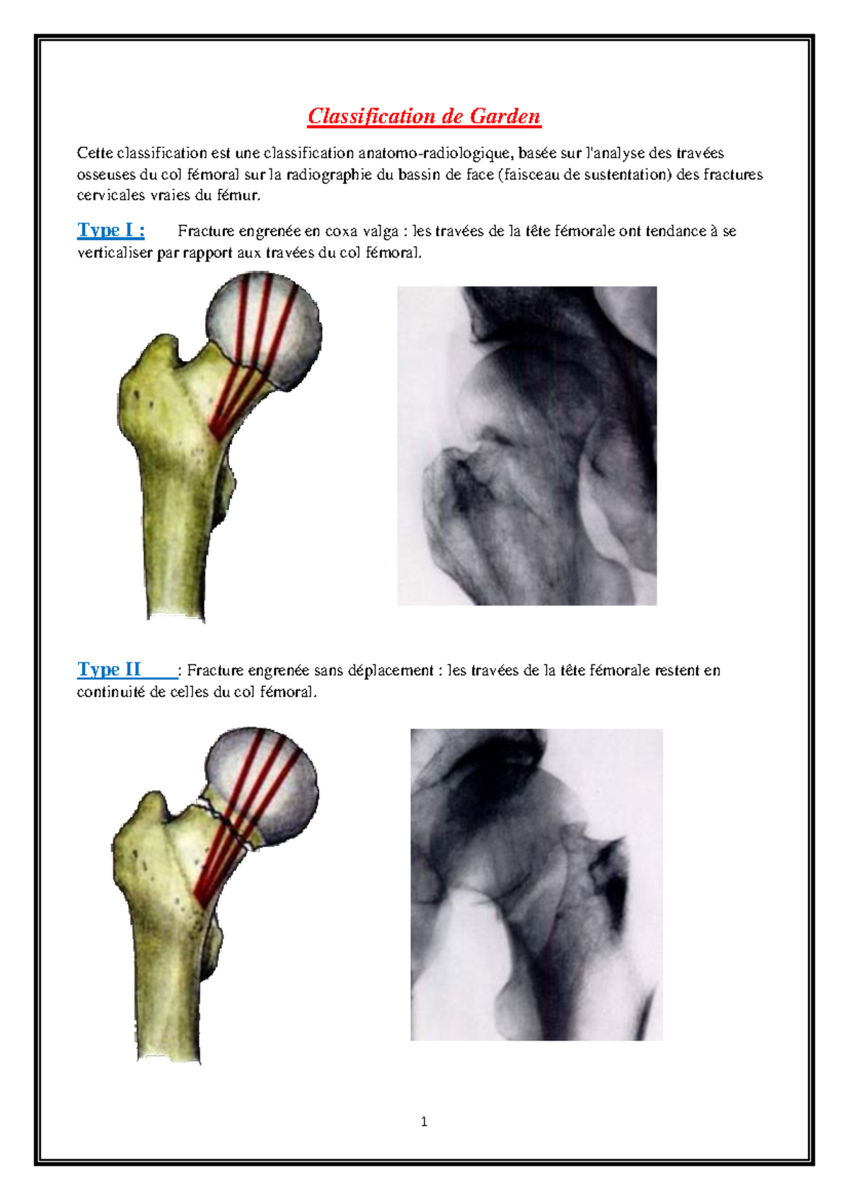 Guide de classification des fractures du col fémoral (AO) - Studocu