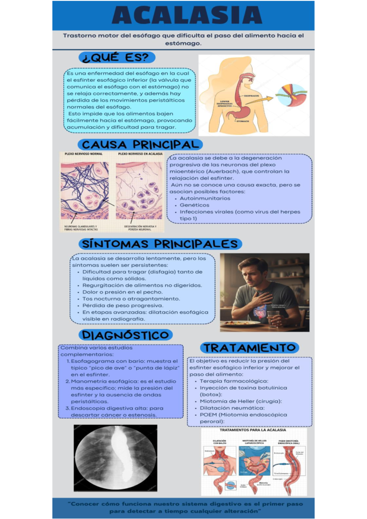 ACALASIA: Trastorno Motor del Esófago y su Tratamiento - Infografía 05 ...