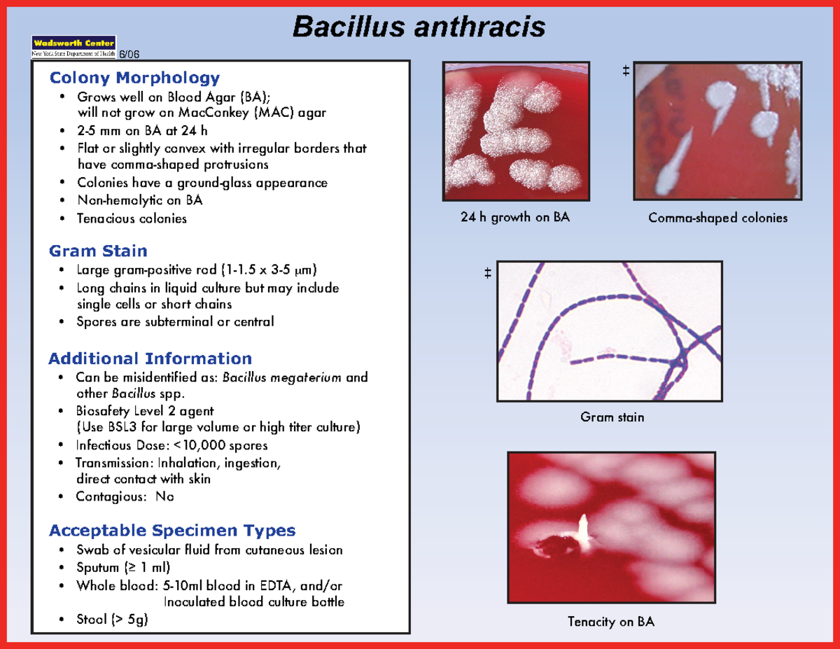 Bacillus anthracis - ++ Bacillus anthracis Colony Morphology . Grows well on Blood Agar (BA ...